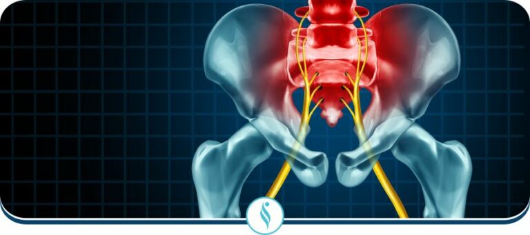 Sciatica Treatment Specialist in Sterling Heights and Dearborn MI